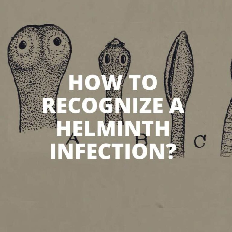 How to recognize a helminth infection? - SIXMD - Vietnamese Online Shop